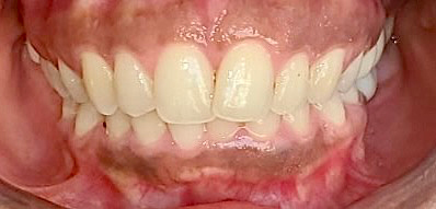 Smile Gallery - Moritis & Shin Dentistry